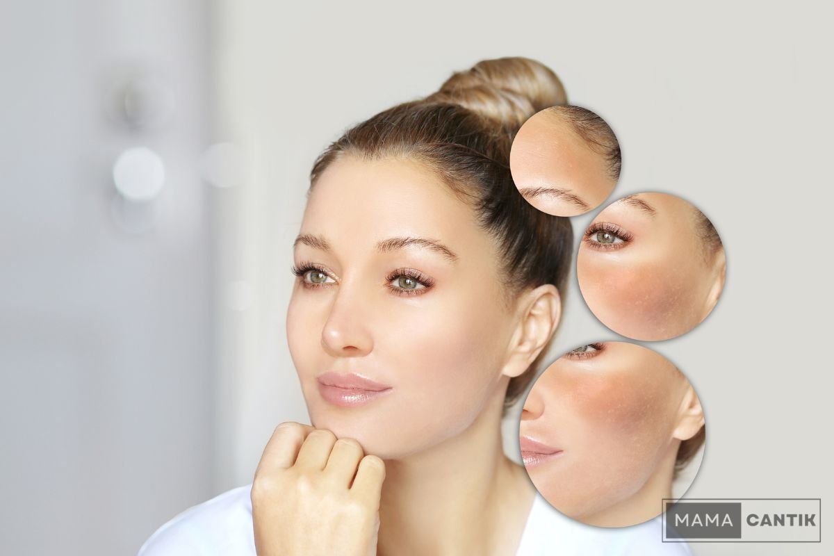 Bintik Hitam di Wajah: Penjelasan, Penyebab, Cara Mengatasi